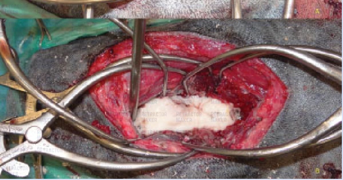 What is a Gelpis Retractor? Features, Uses, and Benefits